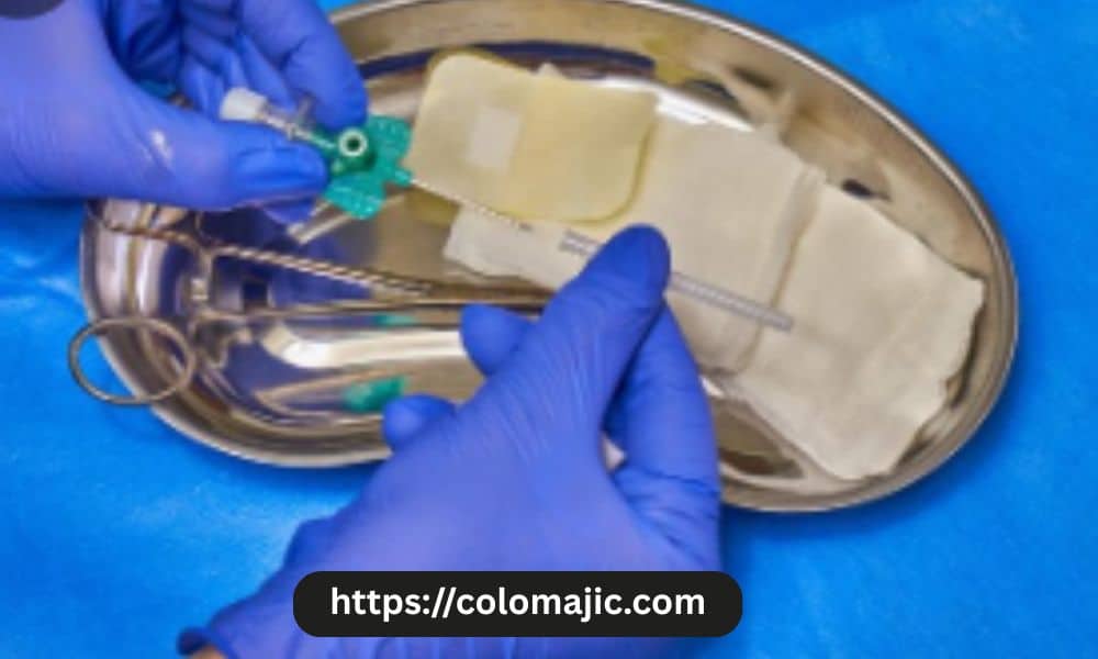 A Guide To Ostomy Bag Supplies And Pouching Systems